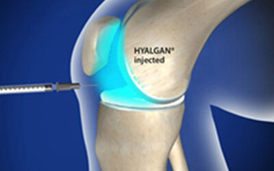 Physical Medicine in Alhambra, CA | United Integrated Healthcare Center